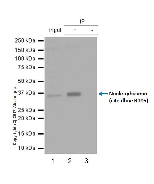 Anti-Nucleophosmin (citrulline R196) antibody [EPR20172] (ab208015) | Abcam