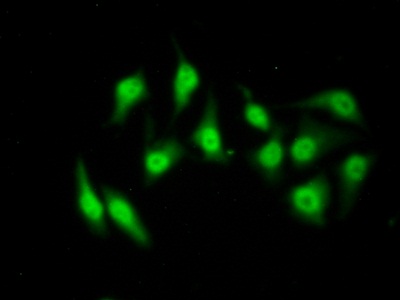 Anti-Nucleoporin p62/NUP62 antibody (ab232816) | Abcam