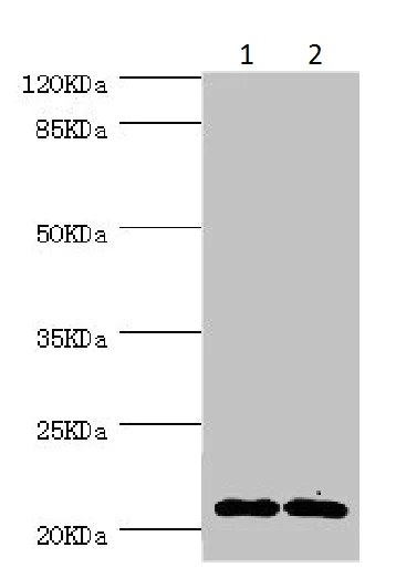Nucleoside-diphosphate kinase抗体 (ab225940)| Abcam中文官网