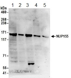 Anti-NUP155 antibody (ab157104) | Abcam