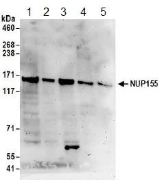 Anti-NUP155 antibody (ab157104) | Abcam