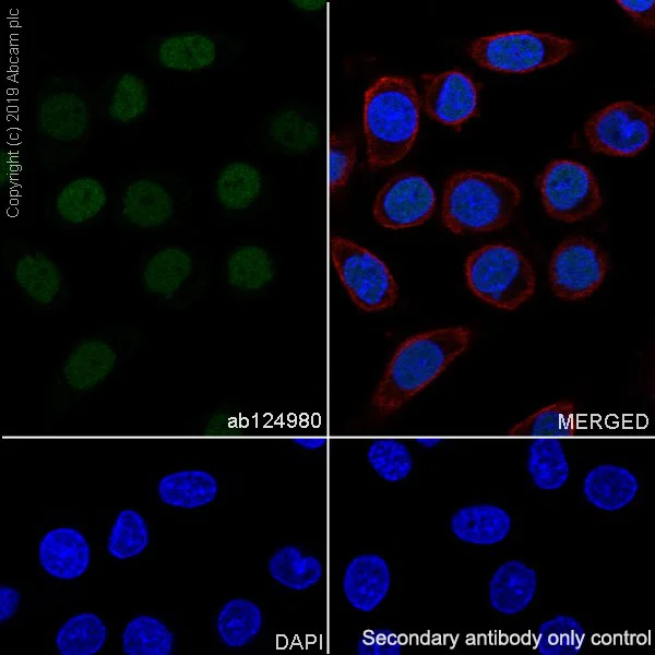 Anti-NUP98 antibody [EPR6678] - Nuclear Pore Marker (ab124980) | Abcam
