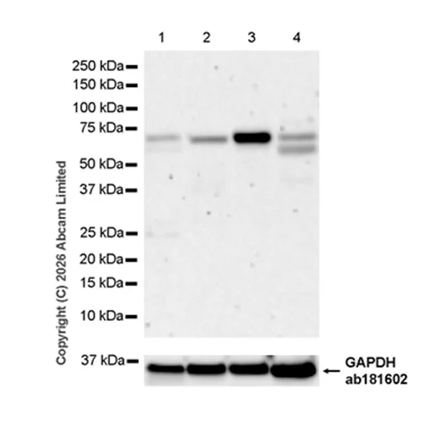 Anti-Nurr1 antibody [EPR26338-73] - BSA and Azide free (ab326956 ...