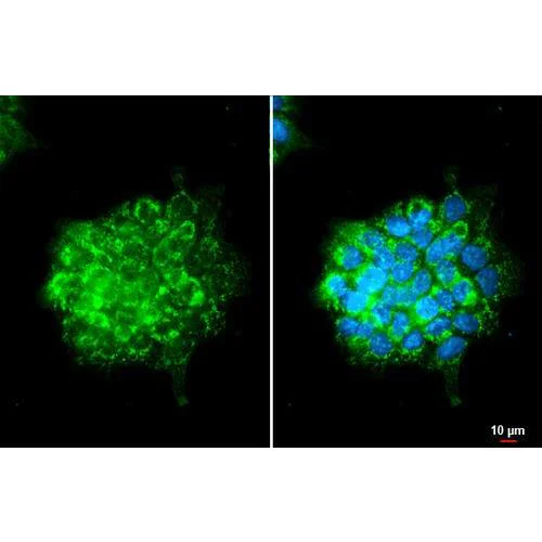 Anti-OAT antibody [HL2088] (ab317132) | Abcam中文官网