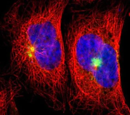 Anti-OAZ1 antibody (ab224080) | Abcam