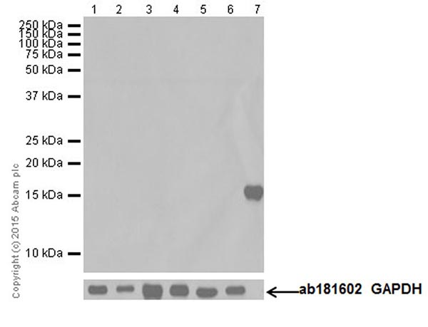 Anti-Olfactory Marker Protein/OMP antibody [EPR19157] (ab183948) | Abcam