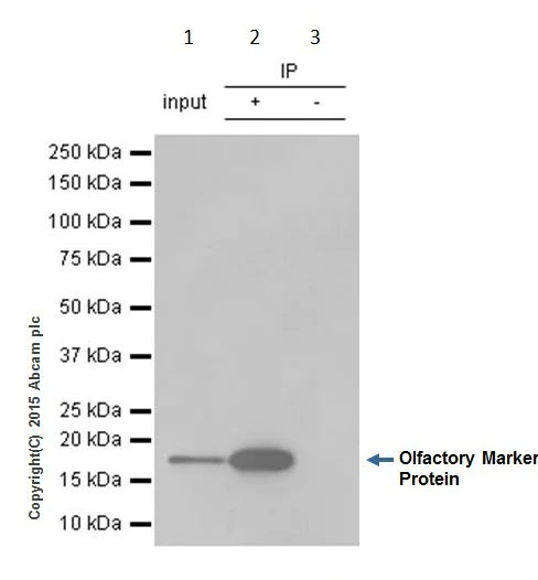 Anti-Olfactory Marker Protein/OMP antibody [EPR19190] (ab183947) | Abcam
