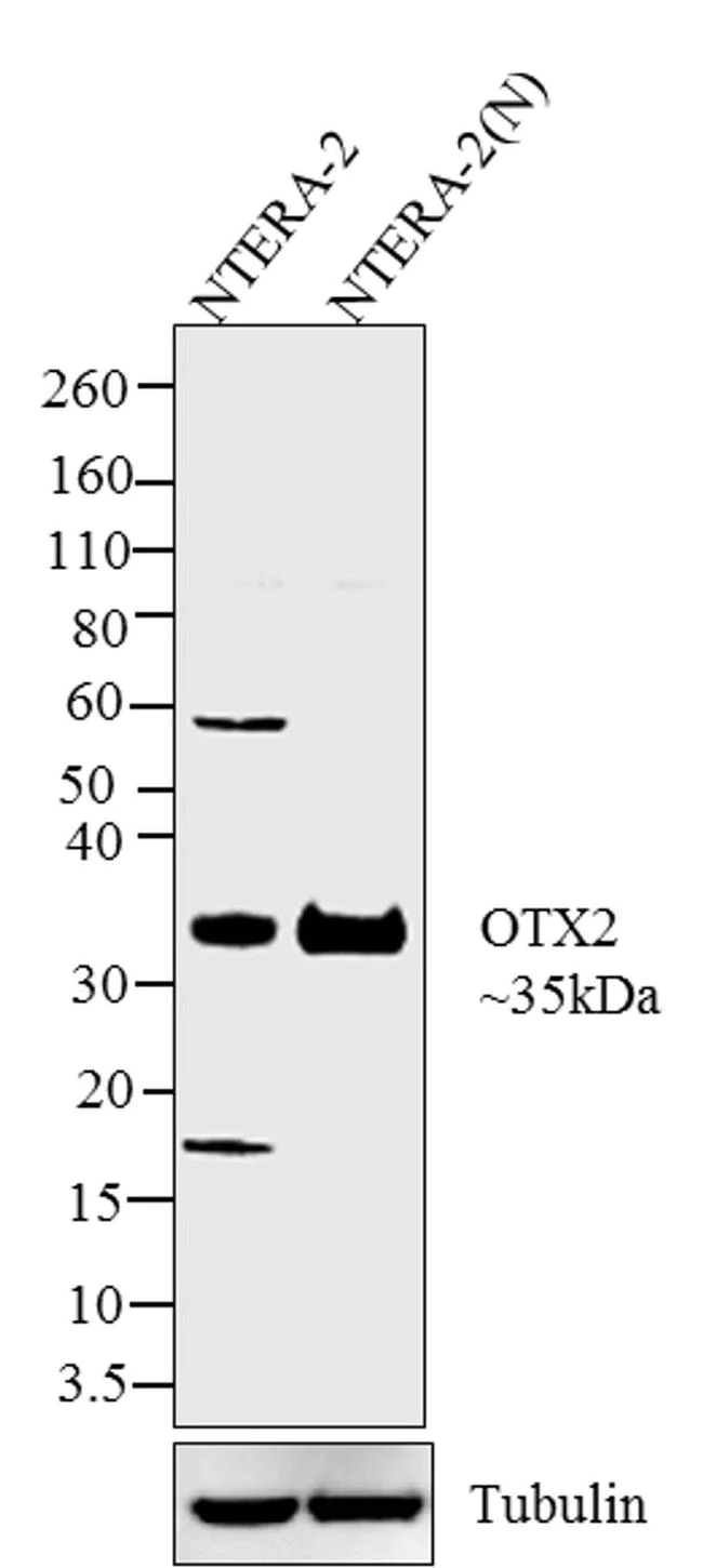 Anti-Otx2 Antibody [RP23040134] (ab313452) | Abcam