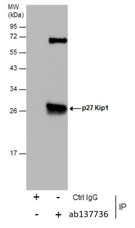 p27 KIP 1抗体 (ab137736)| Abcam中文官网