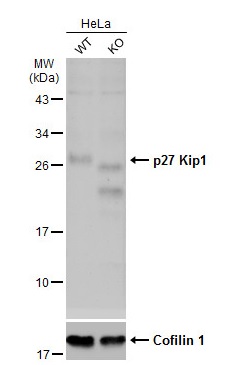 Anti-p27 KIP 1 antibody (ab137736) | Abcam