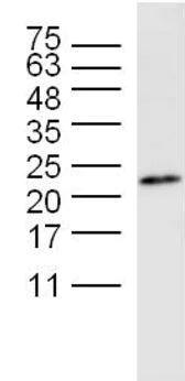 Anti-p27 KIP 1 antibody (ab215434) | Abcam
