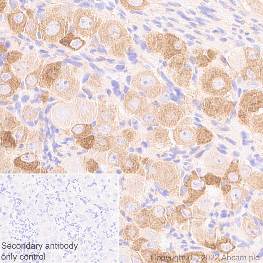Anti-P2X3 antibody [EPR26568-3] Rabbit monoclonal (ab300493) | Abcam