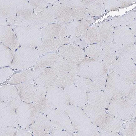 Anti-P2X4 antibody (ab243734) | Abcam