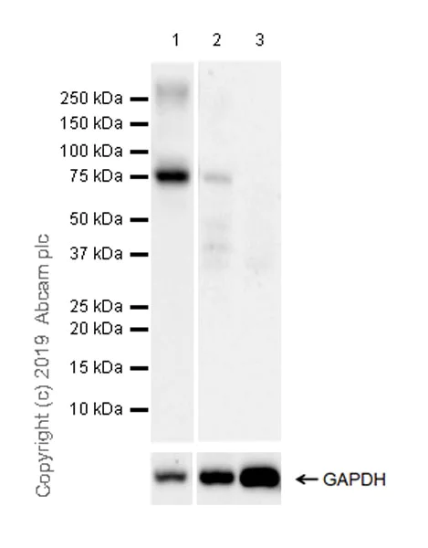 p40 - DeltaNp63抗体[EPR17863-47] (ab203826)| Abcam中文官网