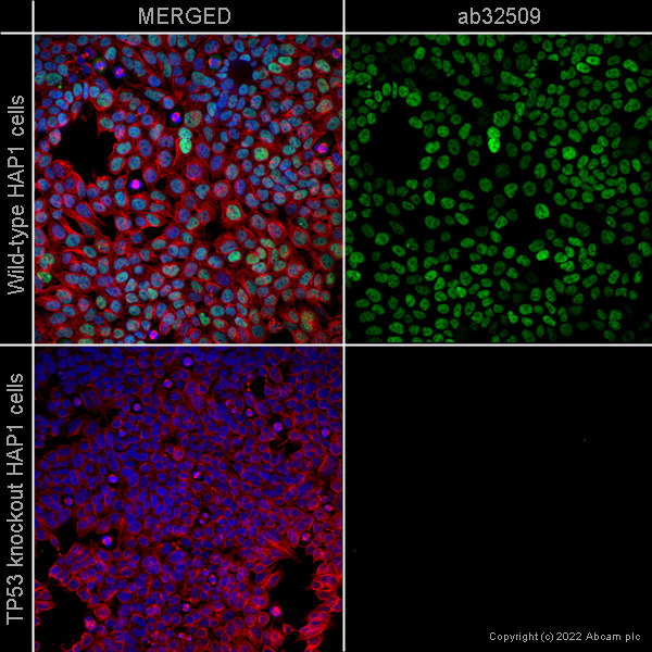 Anti-p53 antibody [E47] (ab32509) | Abcam