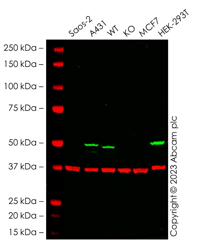 Anti-p53 antibody [E47] (ab32509) | Abcam