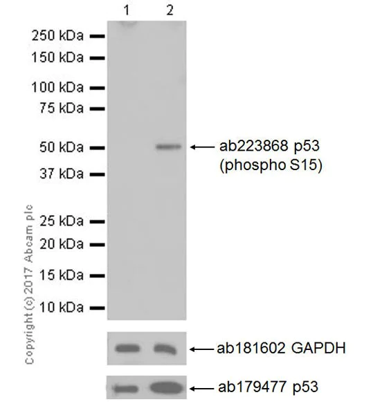 Anti-p53 (phospho S15) antibody [EPR64(N)] - ChIP Grade (ab223868) | Abcam