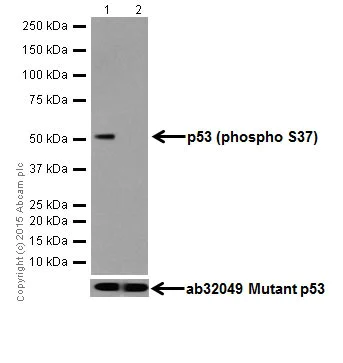 Anti-p53 (phospho S37) antibody [EPR17353] (ab182164) | Abcam