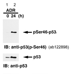 Anti-p53 (phospho S46) antibody [36] (ab122898) | Abcam