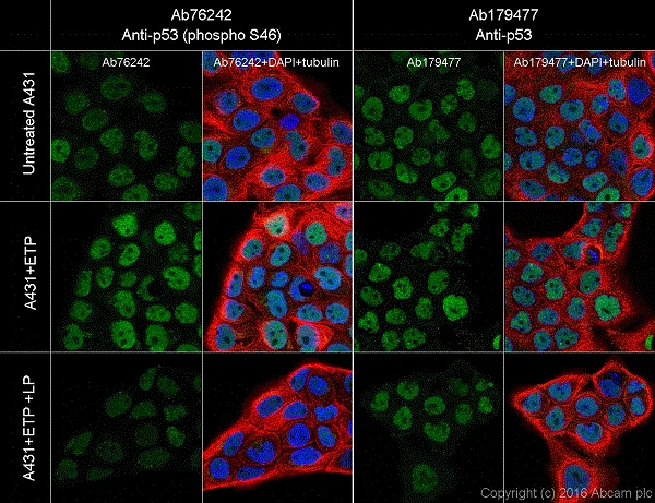 Anti-p53 (phospho S46) antibody [EP42Y] (ab76242) | Abcam