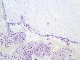 Anti-p57 Kip2 antibody [SP118] (ab231439) | Abcam