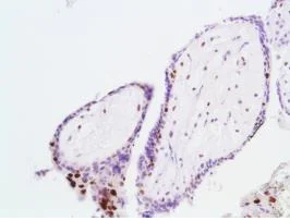 Anti-p57 Kip2 antibody [SP118] (ab231439) | Abcam