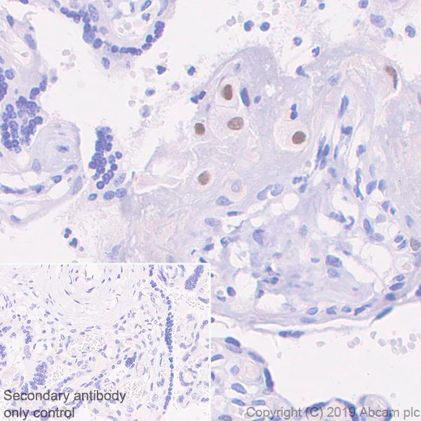 Anti-p57 Kip2 antibody [SP118] (ab231439) | Abcam