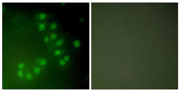 Anti-p63 antibody (ab53039) | Abcam