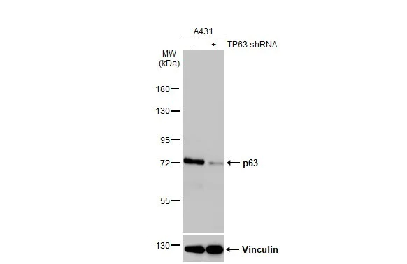 Anti-p63 antibody [HL1027] - BSA and Azide free (ab308376) | Abcam