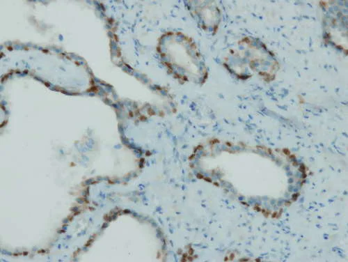 Anti-p63 antibody [I27-I] (ab169707) | Abcam