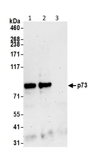 Anti-p73 antibody (ab14430) | Abcam