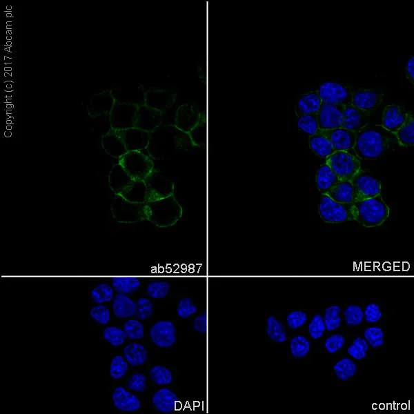 Anti-p75 NGF Receptor antibody [EP1039Y] - BSA and Azide free (ab256584 ...