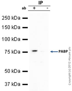 Anti-PABP antibody [10E10] (ab6125) | Abcam