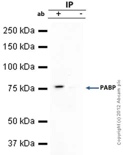 Anti-PABP antibody [10E10] (ab6125) | Abcam