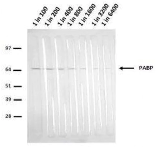 Anti-PABP antibody [10E10] (ab6125) | Abcam