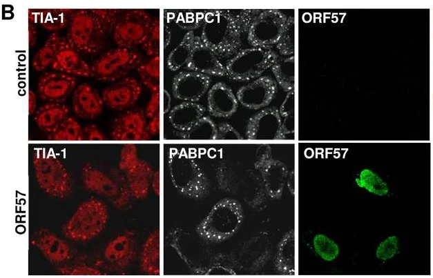 PABP抗体 (ab21060)| Abcam中文官网