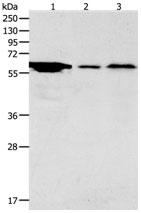 Anti-PACAP receptor/ADCYAP1R1 antibody (ab183103) | Abcam