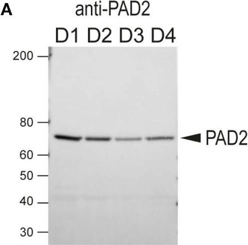 Anti-PADI2 / PAD2 antibody (ab16478) | Abcam