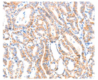 Anti-PAFAH2 antibody (ab199293) | Abcam