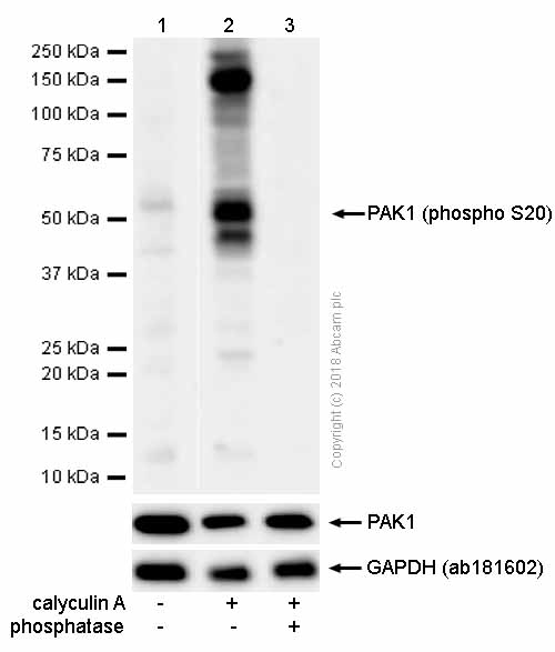 PAK1(磷酸化T212)抗体 (ab75599)| Abcam中文官网