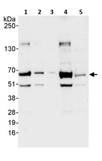 Anti-PAK2 antibody (ab245541) | Abcam