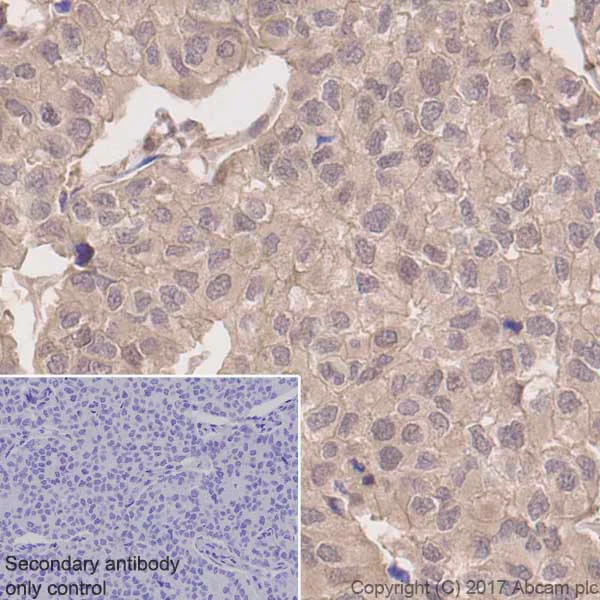 Anti-PAK2 antibody [EP796Y] (ab76293) | Abcam