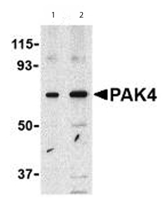 Anti-PAK4 antibody (ab62509) | Abcam