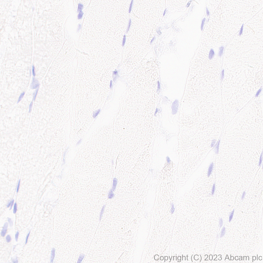 Anti-pan cytokeratin antibody [EPR28285-45] (ab308262) | Abcam