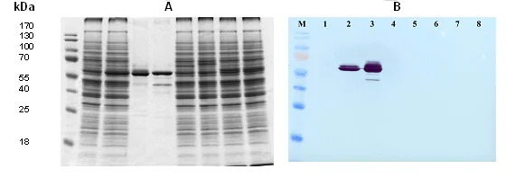 Anti-Parainfluenza Virus type 1 nucleocapsid antibody [7F5] (ab34752 ...
