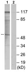 Anti-Parathyroid Hormone Receptor 1/PTH1R antibody (ab75150) | Abcam