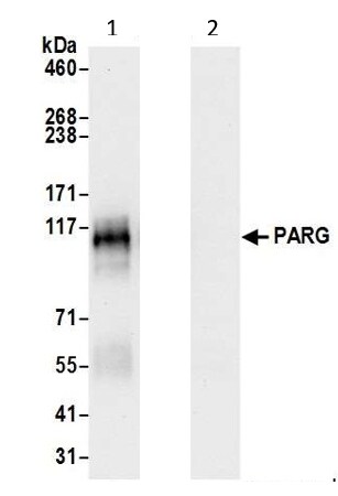 Anti-PARG antibody (ab217129) | Abcam