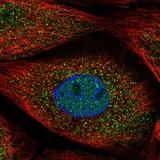 Anti-PARM-1 antibody (ab122452) | Abcam