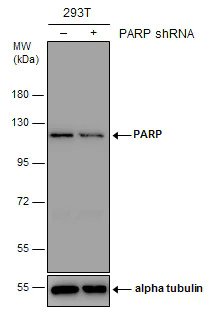 PARP1抗体 (ab137653)| Abcam中文官网