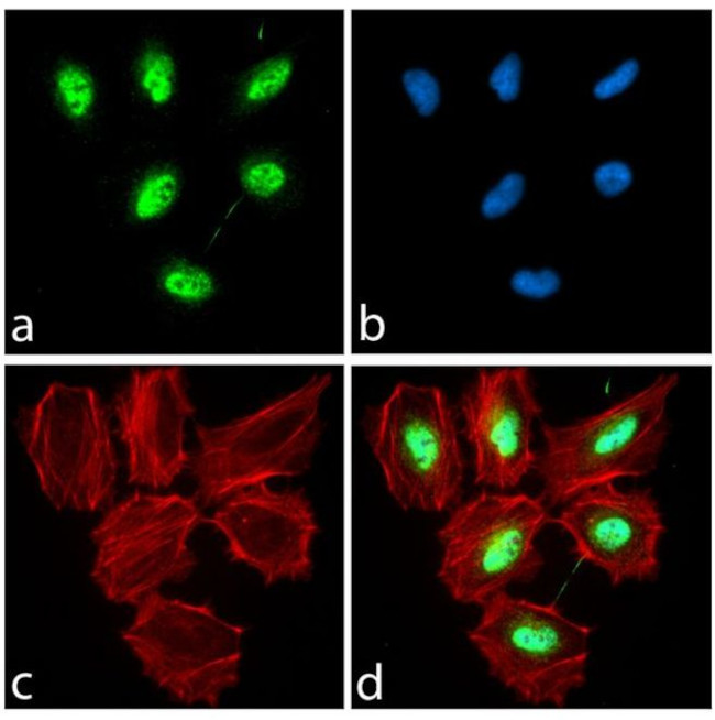 Anti-PAX3 antibody [RP23040034] (ab307998) | Abcam